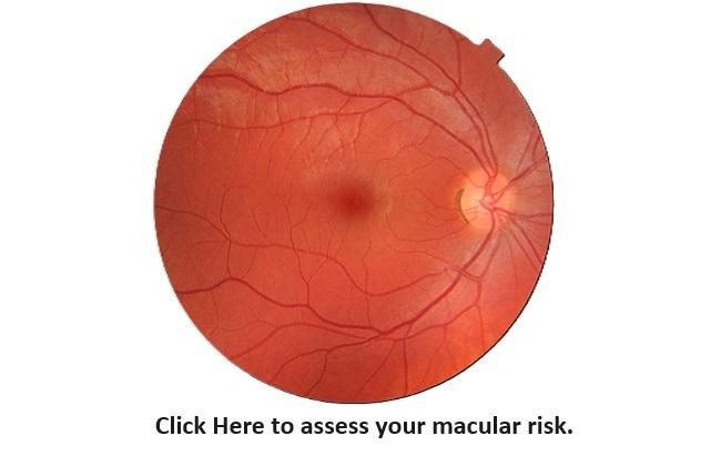 Check your Macular Risk: Blog | Opticians in Prudhoe - Evans Opticians ...